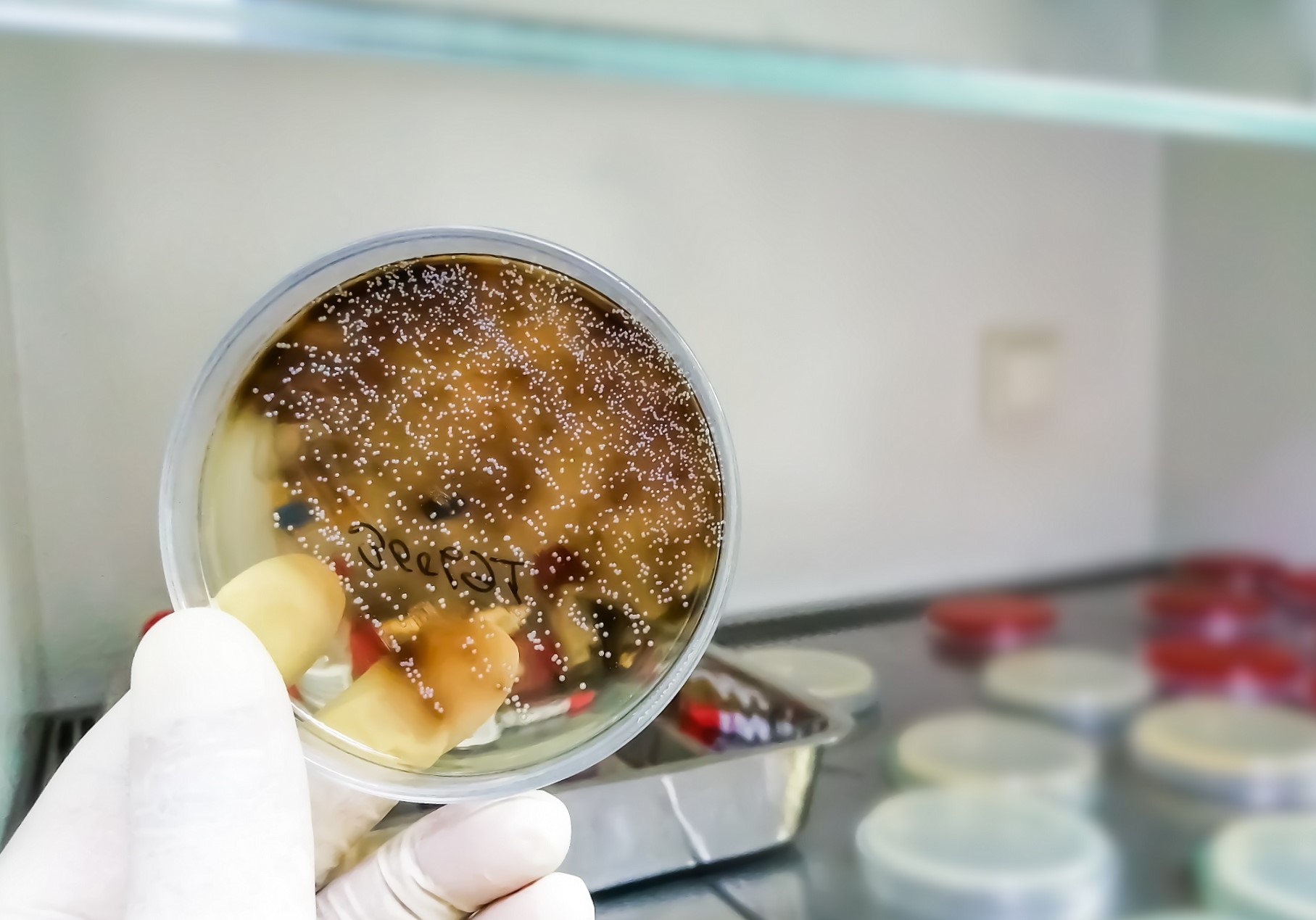 El Zapper y cómo te ayuda a combatir hongos - Merlin Salud